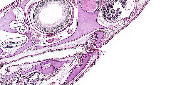 Staining Under the Microscope: techniques and troubleshooting ...